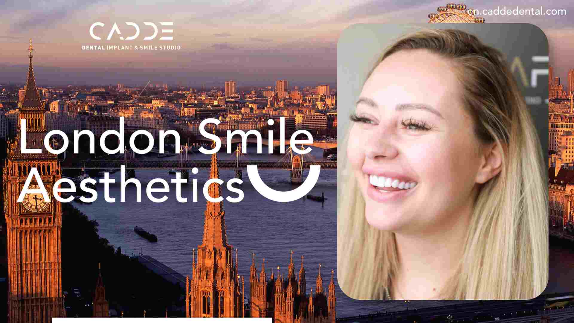 What is Hollywood Smile Prices Turkey | Cadde Dental Clinic